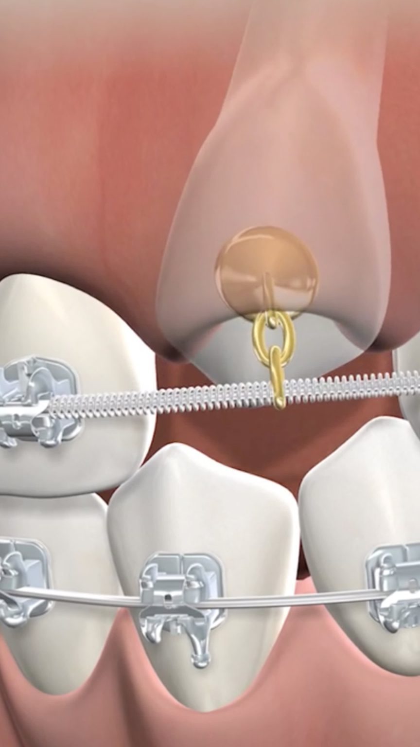 Oral Surgeon Springfield | Oral & Facial Surgeons of Illinois, located ...